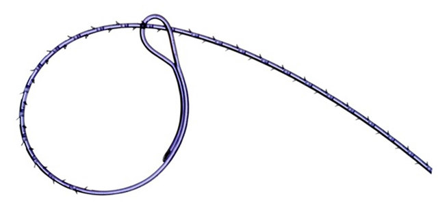 Verbesserte Narbenheilung nach einer Operation - Feldkirchen