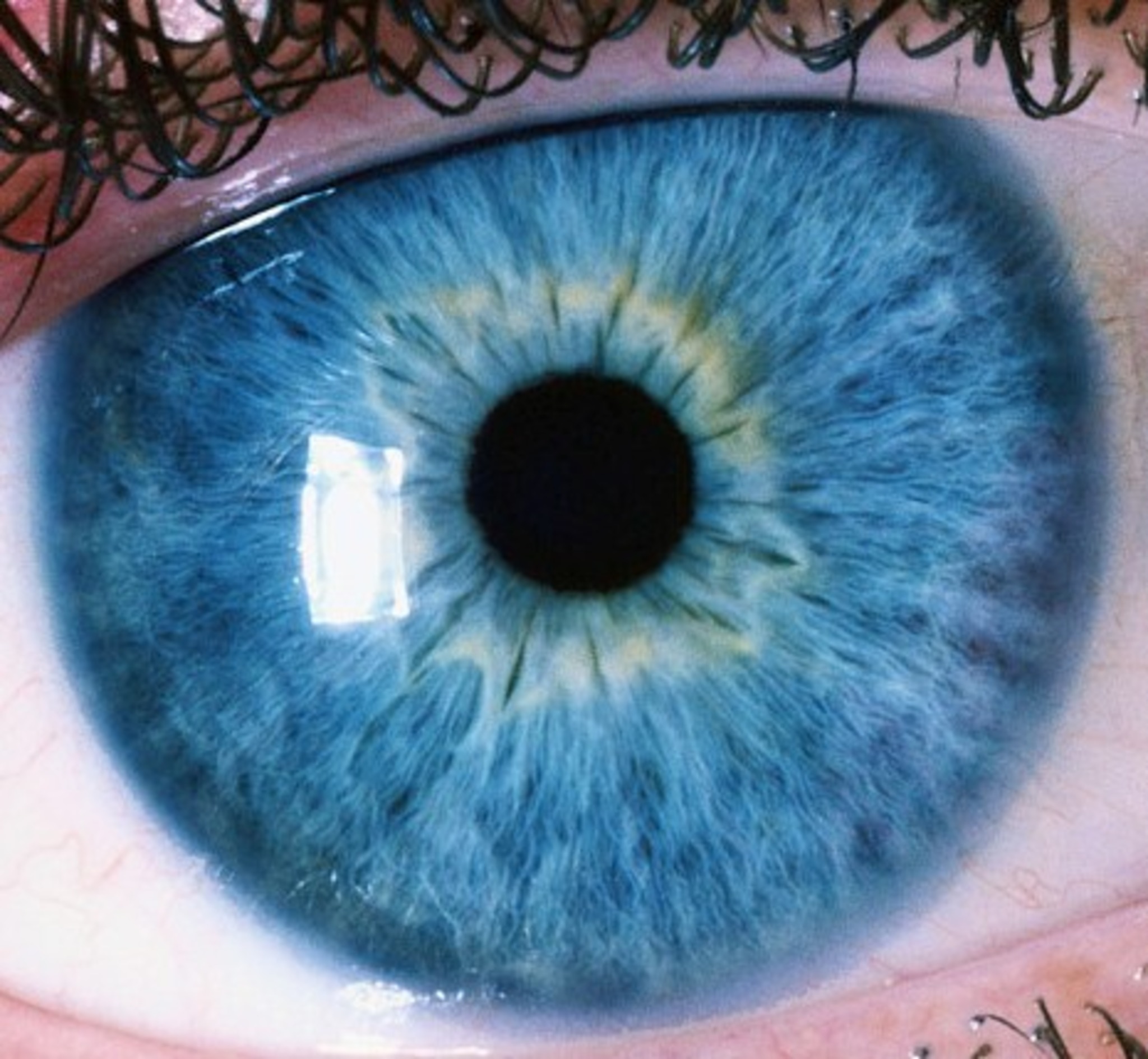 Einführung in die Iris-Diagnose 28.04.2012 14 Uhr- Gesundheits & Reform ...