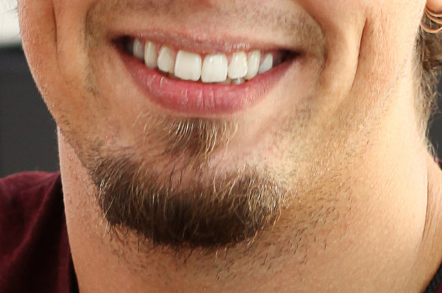 Moustache, Goatie & Co. – Mann trägt wieder Bart - Ried