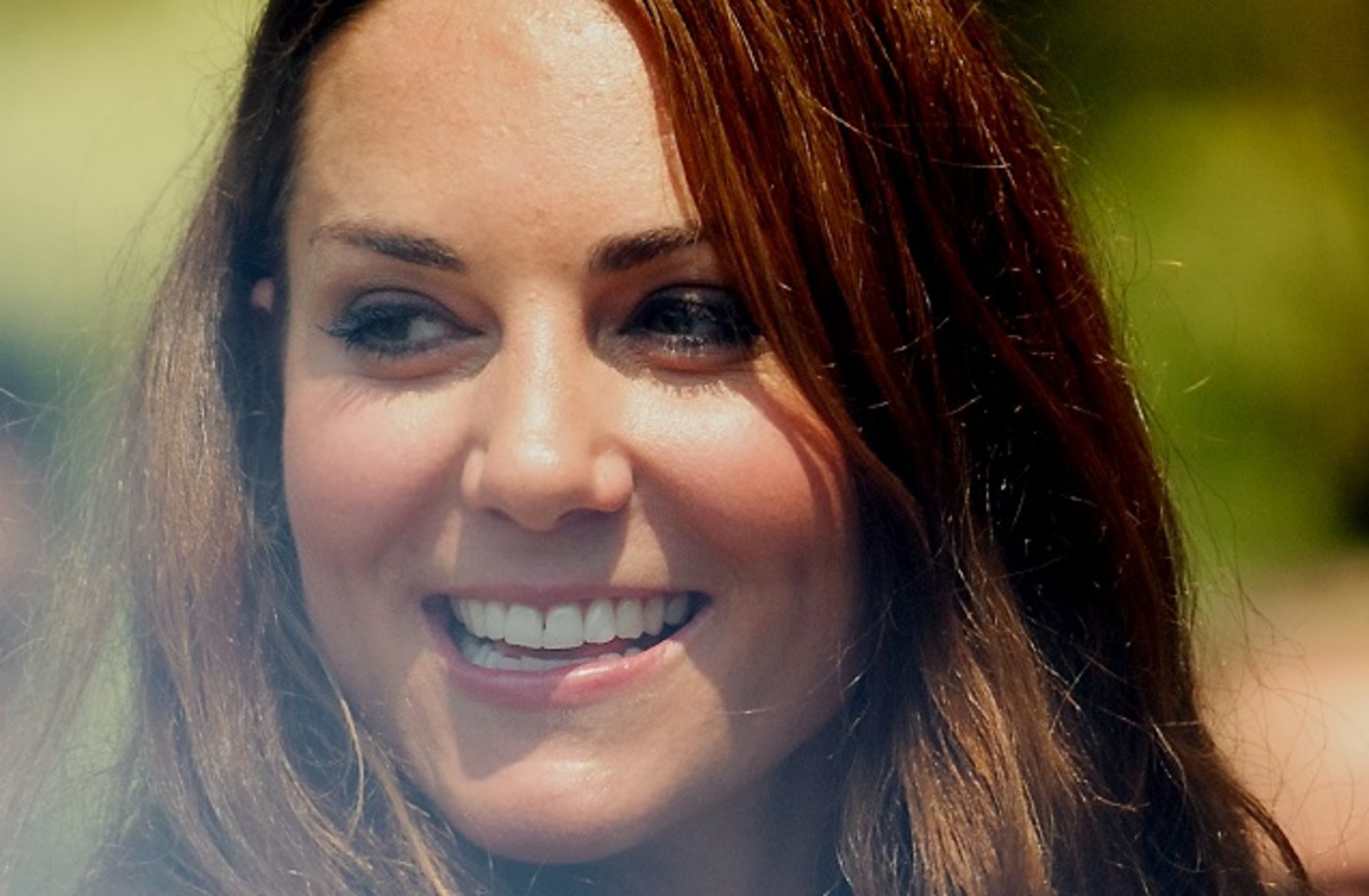 Kate Middleton: Botox? Das Geheimnis ihrer faltenfreien Haut