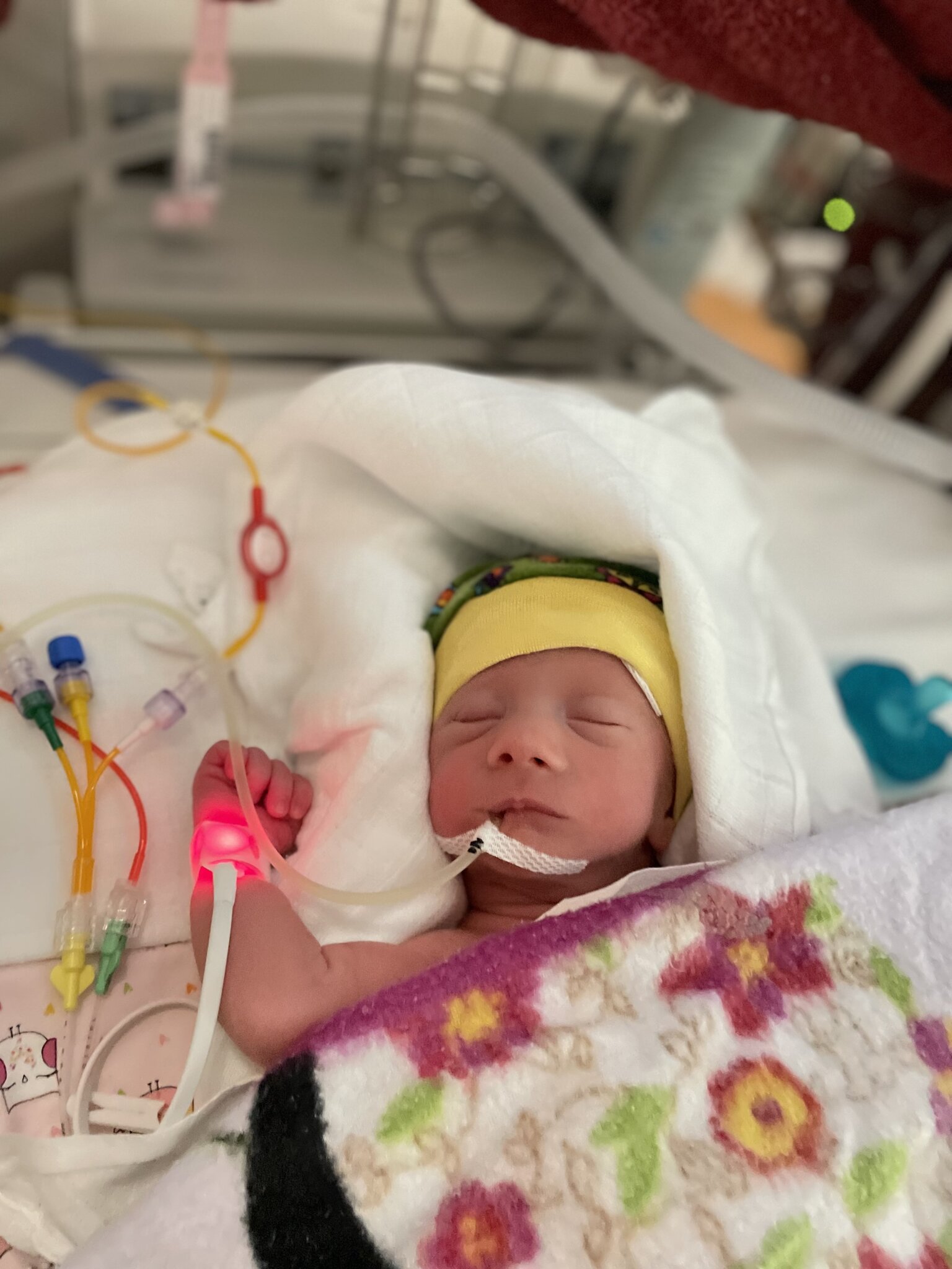 Helfen Sie mit: Baby Elina braucht lebensrettende Stammzellenspende - Linz