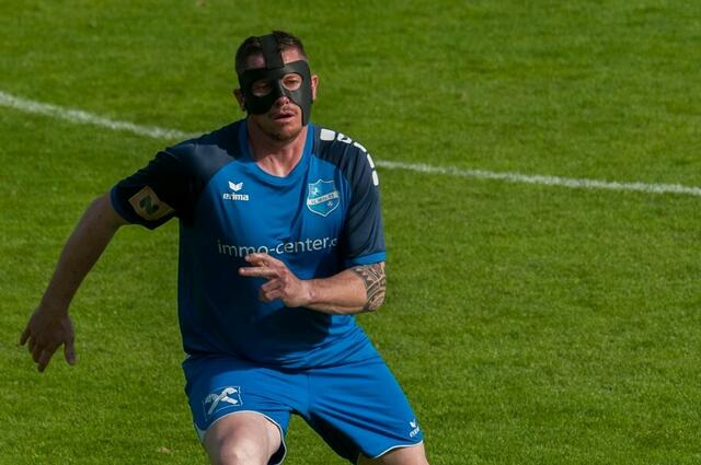 Nach Jochbeinbruch: Fußballer steht dank Maske aus dem 3-D-Drucker ...