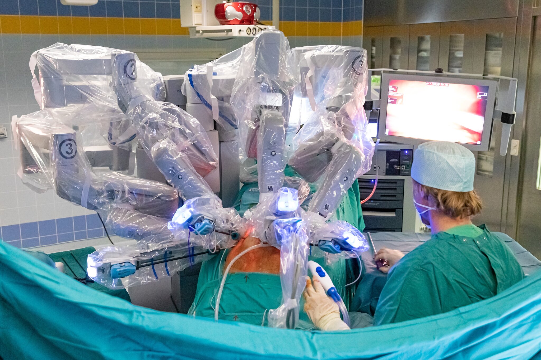 "daVinci": 10.000 Operationen mittels Roboterchirurgie in KHBB Wien ...